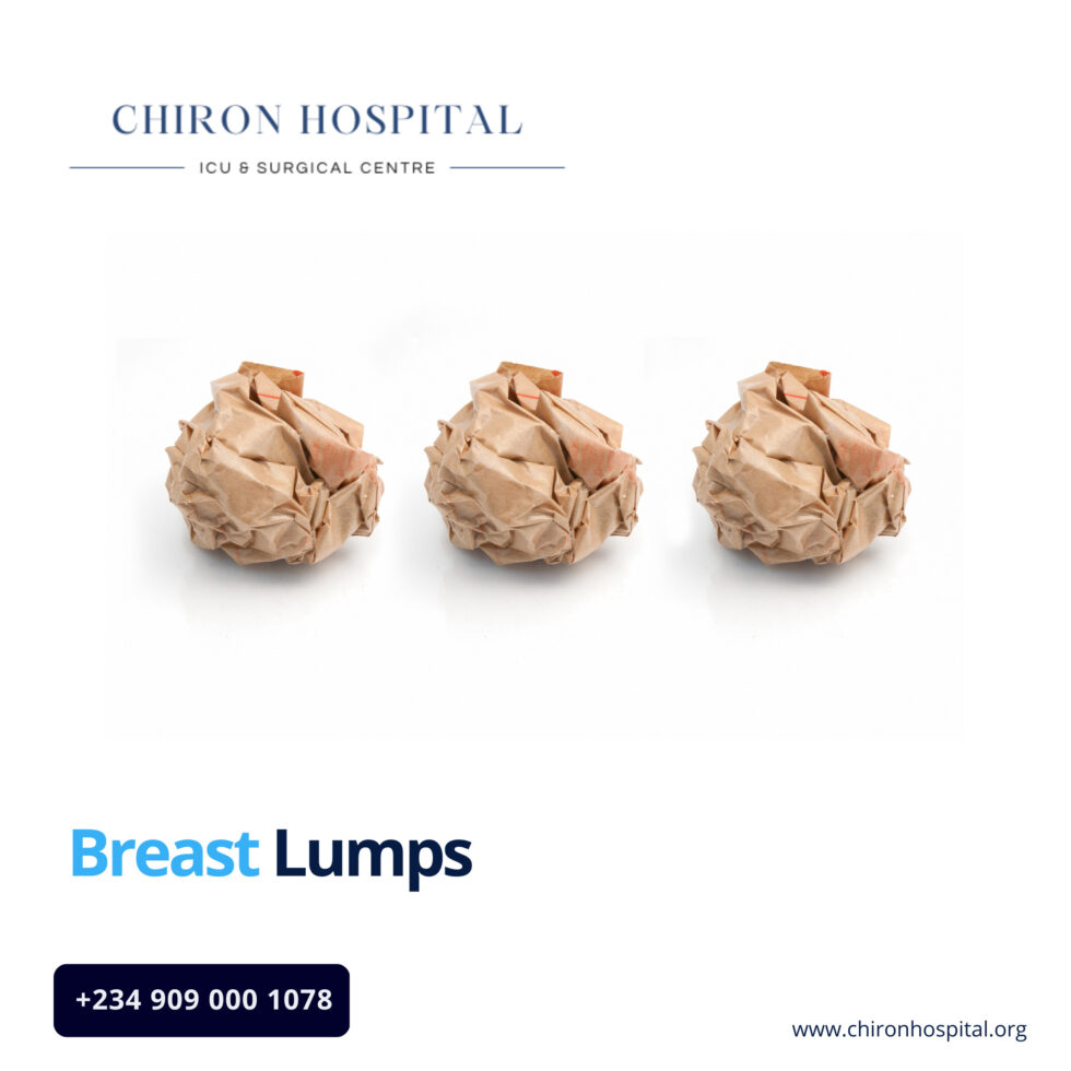 Understanding Breast Lumps: When to Seek Medical Attention | Chiron ...