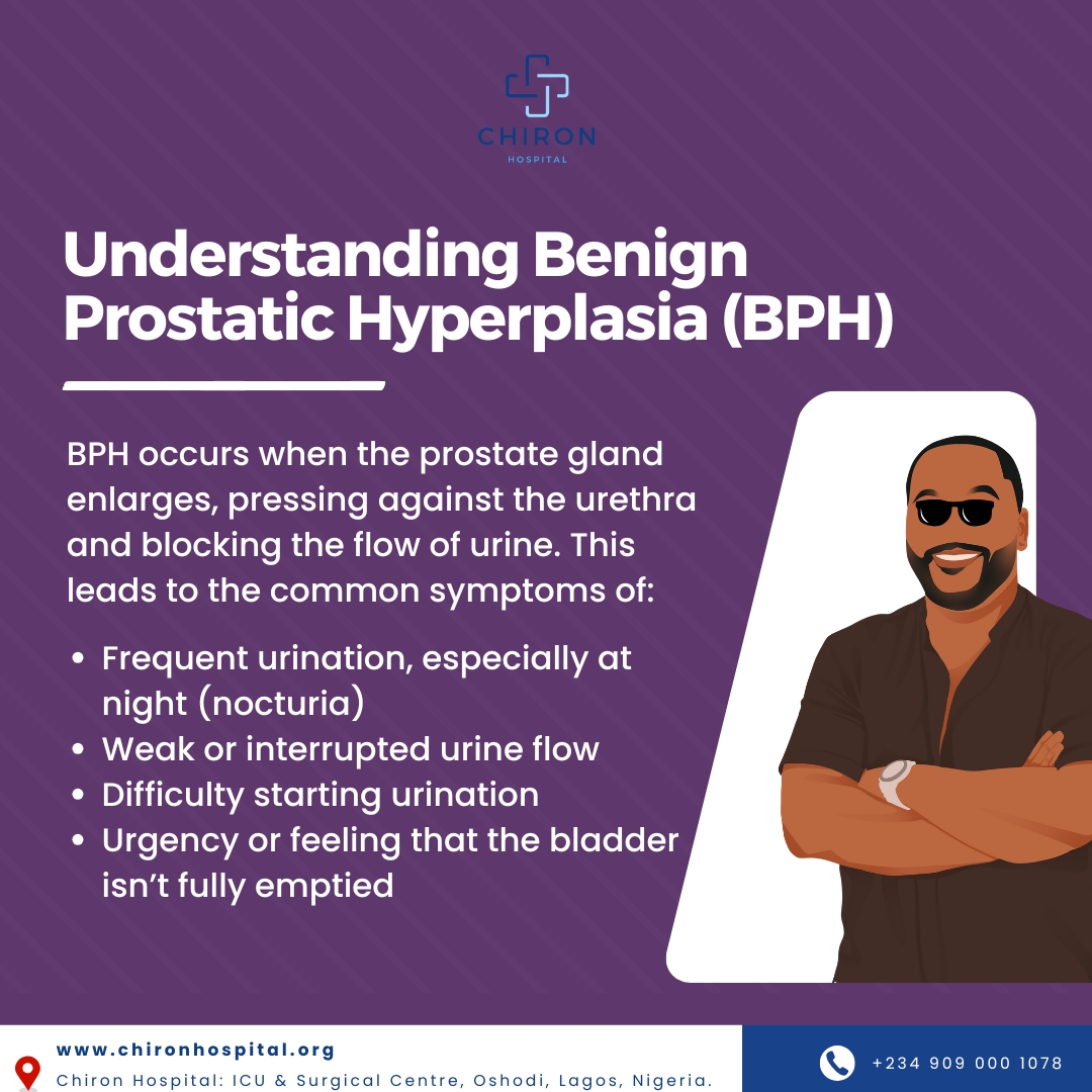Understanding Benign Prostatic Hyperplasia (BPH): Taking Charge of Your Urological Health ...